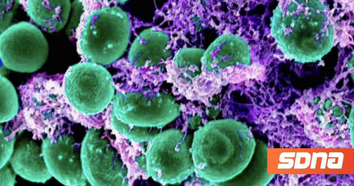 Ποια είναι τα τρία τοξικά και ανθεκτικά μικρόβια που μπορεί να σκοτώσουν | SDNA